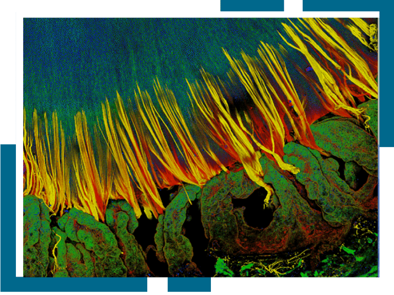 Travel Award Submission - National Foundation for Eye Research